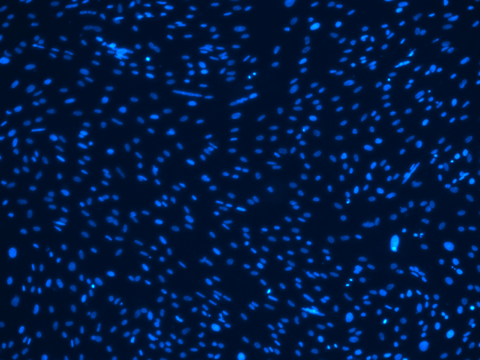 ImageJ: 細胞核のカウント